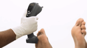 5 in 1 Neuropathy assessment device with biothesiometer