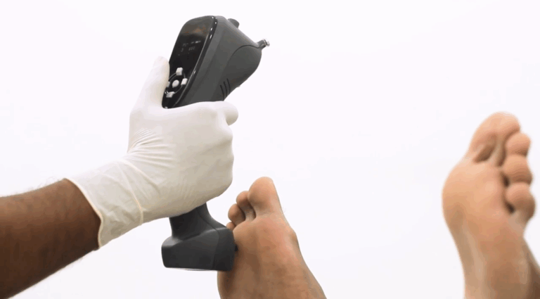 5 in 1 Neuropathy assessment device with biothesiometer