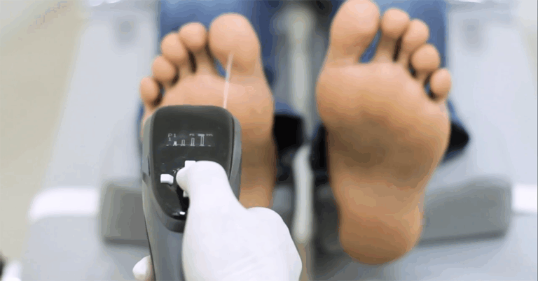 Integrated Diabetic Foot Assessment: Monofilament, Vibration ...